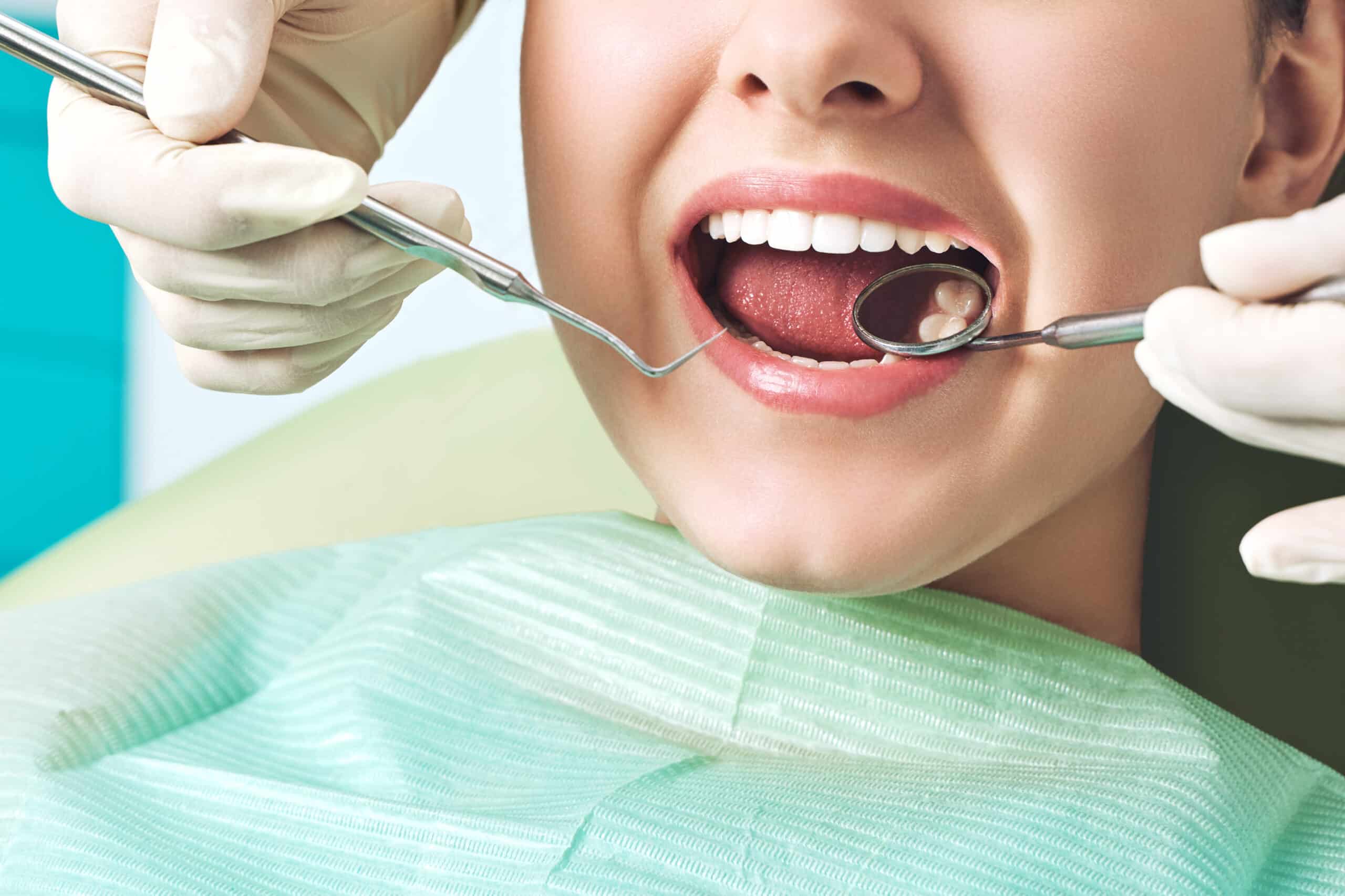 Fighting Cavities in Riverton: Preventive Dentistry That Works